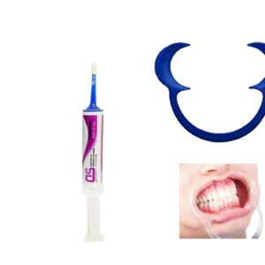 SmileWorld Blue Gel 36 Gm kit - Desmineralization Gel 35 Percent -Dental Etch - Perfect Viscous-Stays Where Placed- Includes Lip Expander - Not Glue - Made in USA (3) Units