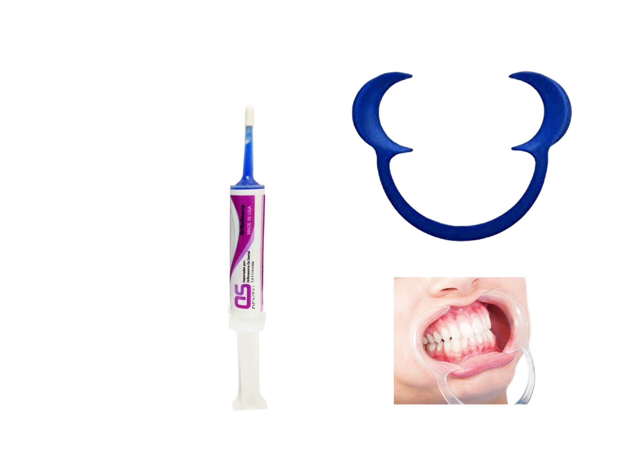 SmileWorld Blue Gel 36 Gm kit - Desmineralization Gel 35 Percent -Dental Etch - Perfect Viscous-Stays Where Placed- Includes Lip Expander - Not Glue - Made in USA (3) Units