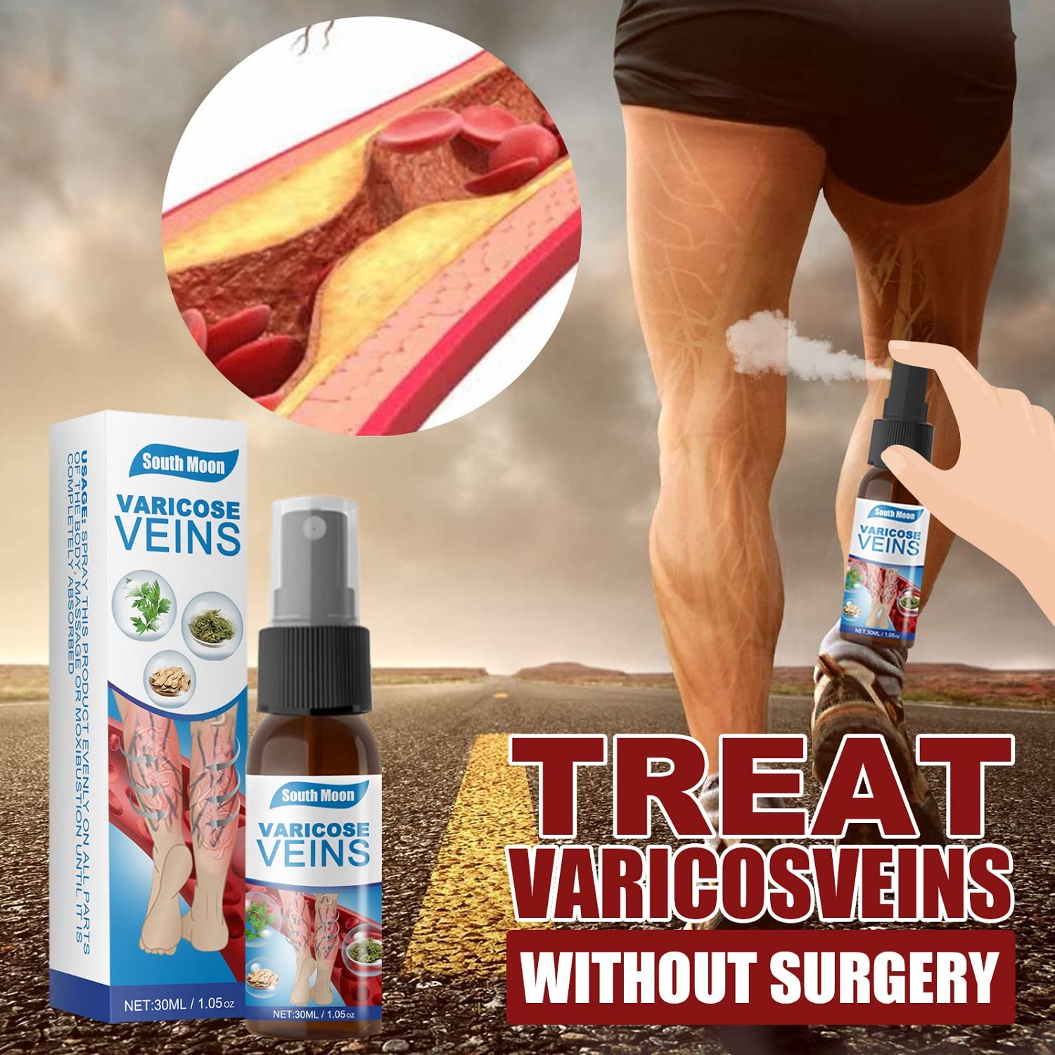 OUKPANE 2pcs Veinhealing Varicose Veins Treatment Spray, Veinhealing Varicose Veins Spray, Vein Healing Varicose Veins Treatment Spray for Legs, Varicose Veins Miracle Spray (30ml)