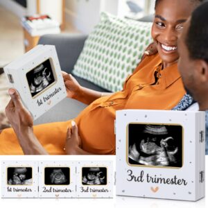 Amyhill Triple Ultrasound Picture Frames, Baby Sonogram Photo Frame Pregnancy Ultrasound Keepsake Frame, Gift for Expecting Parents, Baby Shower Baby Nursery Decor, White