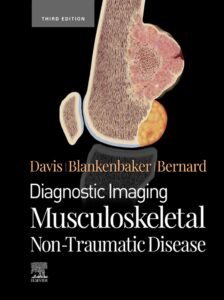 diagnostic imaging: musculoskeletal non-traumatic disease - e-book