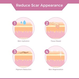 Silicone Scar Tape Scar Sheets - Professional Medical Grade Scar Removal Treatment, Non irritating, Painless for C-Section, Surgical Scars, Burn, Keloid, Acne(1.6” x 60” Roll)