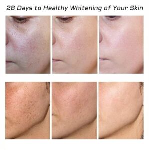 2 Pcs Whitening Freckle Cream, Acne Scar Removal Treatment Cream, Pigmentation Removal Cream for Face, Moisturizing Removes Facial Melasma Dark Spots Wrinkles Blemishes (whitening freckle cream)