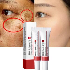 2 pcs whitening freckle cream, acne scar removal treatment cream, pigmentation removal cream for face, moisturizing removes facial melasma dark spots wrinkles blemishes (whitening freckle cream)