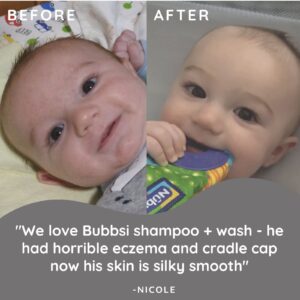 Bubbsi Creamy Coconut Oil Baby Shampoo & Wash | Light Natural Scent | Won't irritate eyes | Organic Coconut Oil + Shea | Gentle, Sulfate-free, Nourishing | Cradle Cap, Eczema (Refillable bottle, 8oz)