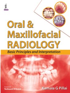 oral & maxillofacial radiology: basic principles and interpretation