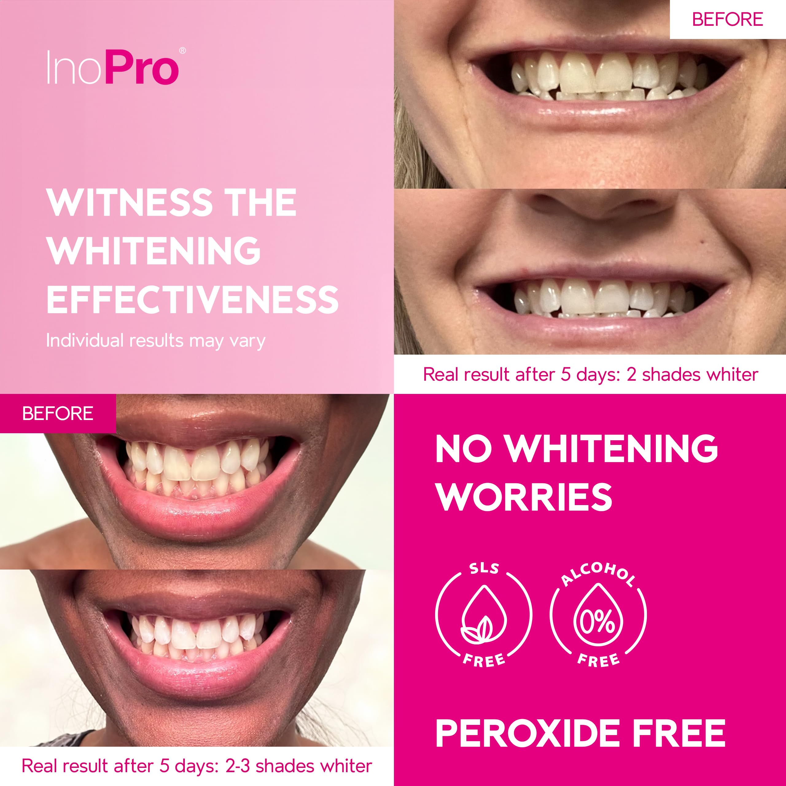 InoPro Teeth Whitening Strips 14 Treatments Kit - Teeth Whitener, Peroxide Free, Enamel Safe Green White Strips, Deep Stains Removal - Instant Teeth Whitening Without The Harm (28 Strips)