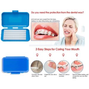 Braces Cleaning Kit for Teeth, Portable Orthodontic Toothbrush Kit Oral Care Dental Travel Kit - Interdental Brush Dental Wax Dental Floss Toothbrush Box (Blue B)