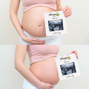 Ultrasound picture Frame, Sonogram Picture Frame with Belly Bump Fruit and Vegetable Signs, Expecting Parents to be Unique Gifts for Pregnant Women, Pregnancy Milestone to Track Baby Grow, White