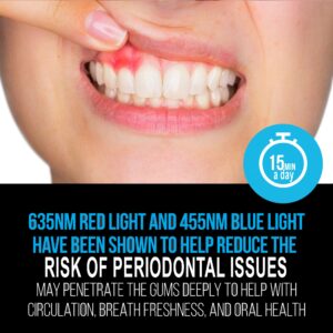 Starlite Smile Blue Light Red Light Gum Light, Periodontal Light, Oral Care, Blue Light Teeth Whitening Accelerator Light