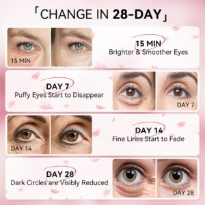 BREYLEE Rose Eye Mask– 60 Pcs - Eye Treatment Mask, Under Eye Bags Treatment, Under Eye Masks for Puffy Eyes, Anti-Aging,Anti-Wrinkle and Fine Lines, Under eye Dark Circles