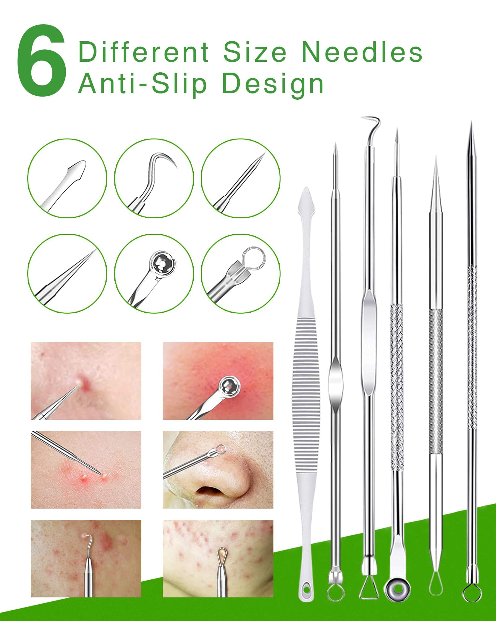 15 PCS Blackhead Remover Pimple Popper Tool Kit,Black Head Removal Extractor for Acne Comedone Whitehead Popping Zit Blemish Facial Skin Care Tools with Metal Case