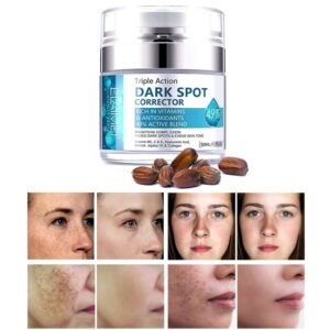 dark spot remover for face, fast-acting dark spot corrector remover for face and body hyperpigmentation, fades melasma, freckle, sun spots, evens skin tone, age spot remover for women men