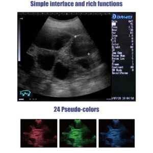 DAWEI S1 Veterinary Ultrasound Machine for Pregnancy Portable Vet Handheld Scanner B-Ultra Sound with 3.5Mhz Convex Probe for Cattle,Pig,Goat,Horse