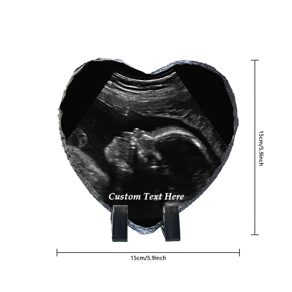 Personalized Custom Photo Heart Rock Slate Ultrasound Picture Frames, Sonogram Picture Frame Pregnancy Gifts for First Time Moms, Mom to Be Gift, Best Gifts for Expecting Mom