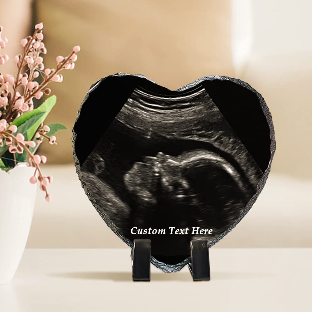 Personalized Custom Photo Heart Rock Slate Ultrasound Picture Frames, Sonogram Picture Frame Pregnancy Gifts for First Time Moms, Mom to Be Gift, Best Gifts for Expecting Mom