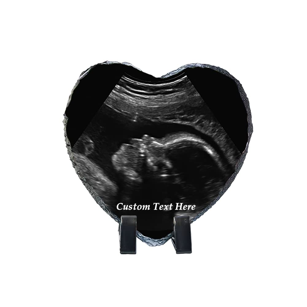 Personalized Custom Photo Heart Rock Slate Ultrasound Picture Frames, Sonogram Picture Frame Pregnancy Gifts for First Time Moms, Mom to Be Gift, Best Gifts for Expecting Mom