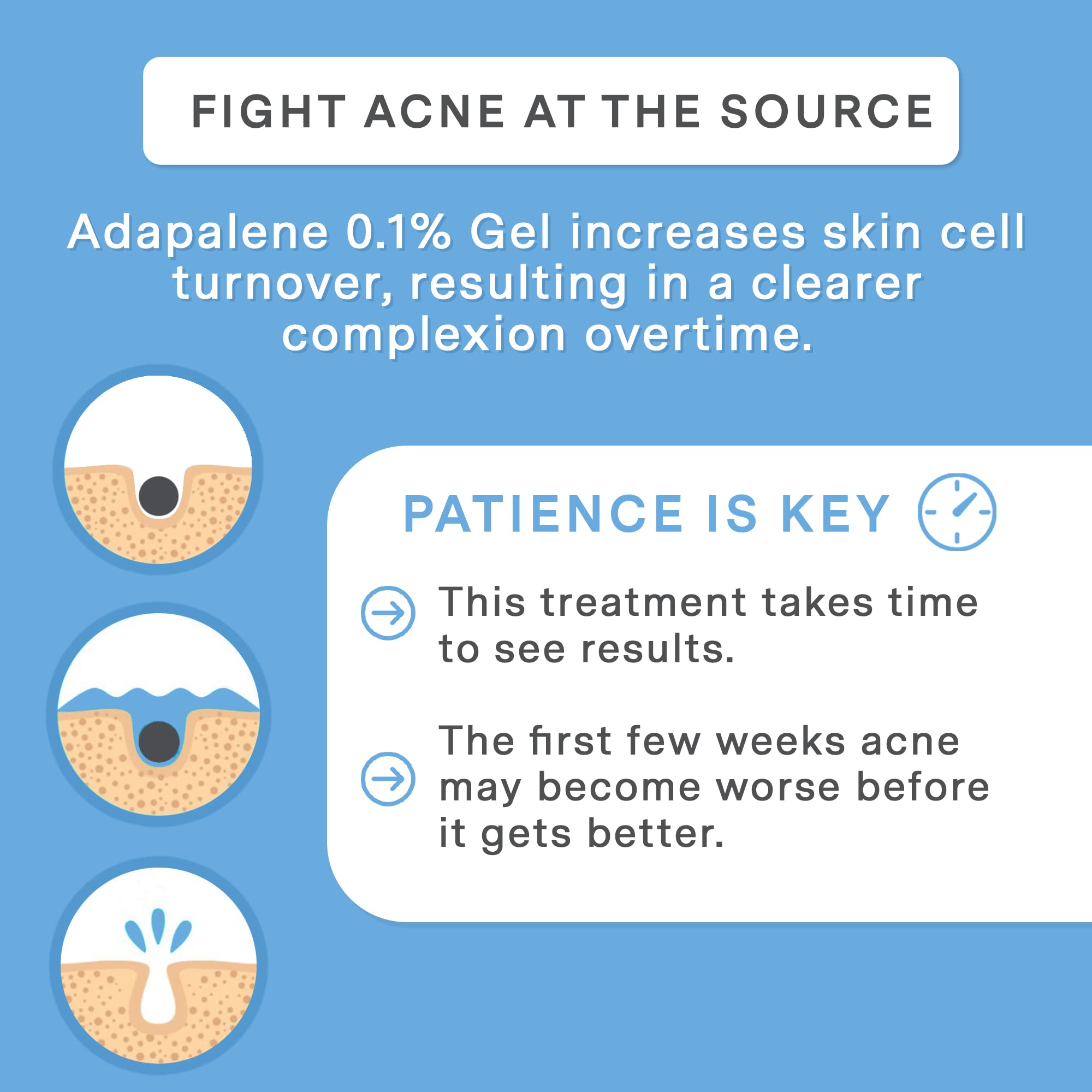 Curist Adapalene 0.1% Acne Free Gel (45gr 1.6oz 90 Day Supply - XL Tube) - Topical Retinoid Acne Medicine - Stop Acne Whiteheads Blackheads & Clogged Pores - Adapalene Retinoid Acne Treatment For Face