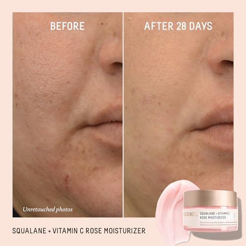 Biossance Squalane + Vitamin C Rose Moisturizer. Antioxidant-Rich Daily Moisturizer to Boost Radiance, Even Skin Tone and Smooth Fine Lines and Wrinkles (1.69 fl oz)