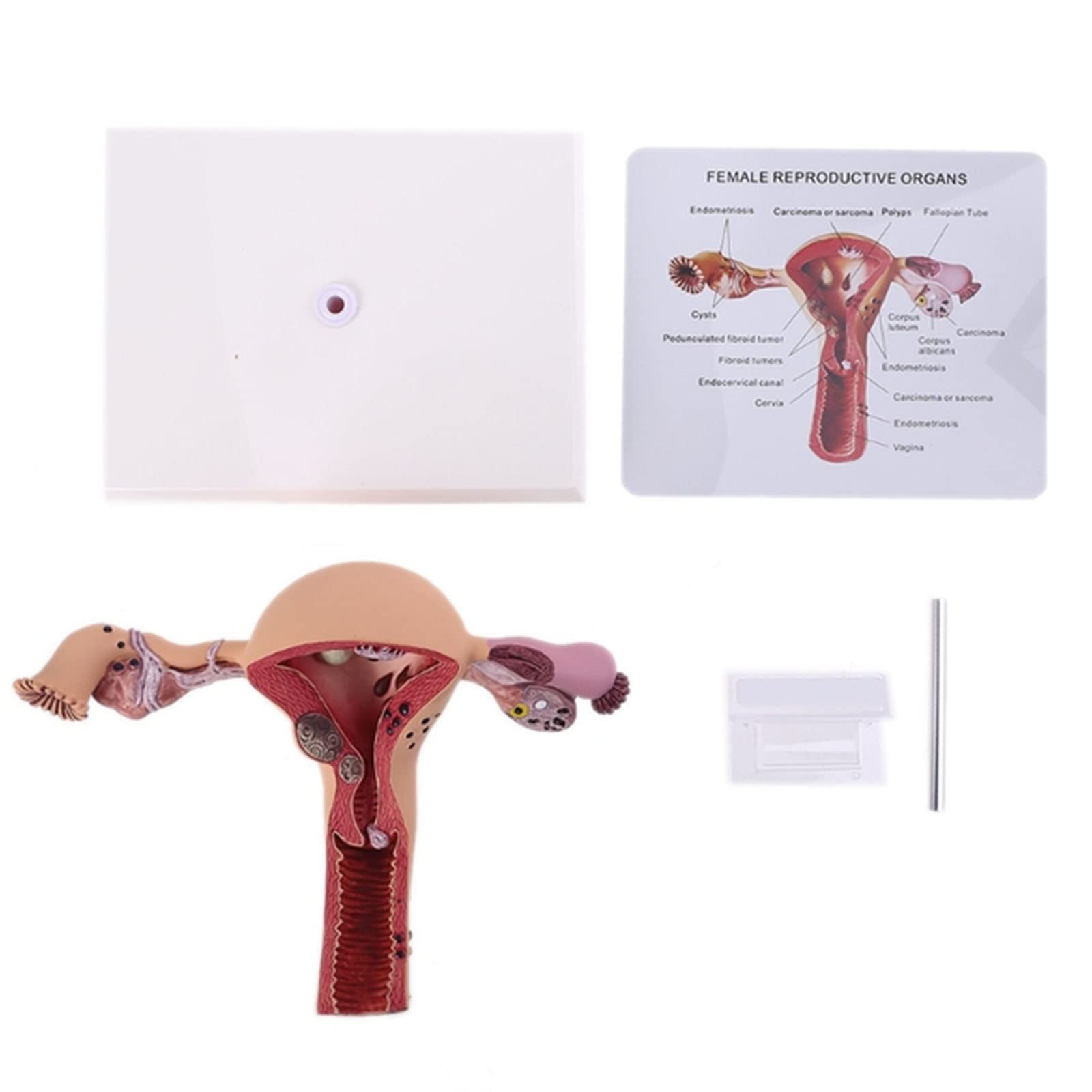 Uterus and Ovary Model, Human Anatomical Model Pathological Female Reproductive Organ Model for School Teaching Demonstration, Educational Tool