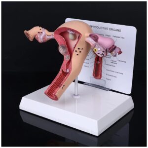 uterus and ovary model, human anatomical model pathological female reproductive organ model for school teaching demonstration, educational tool