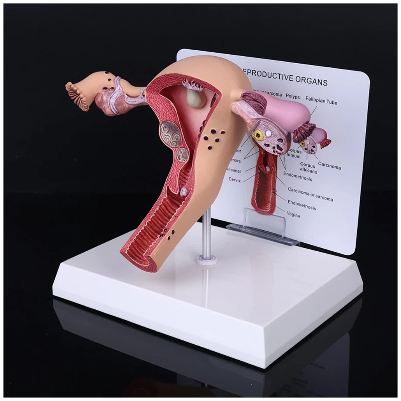 Uterus and Ovary Model, Human Anatomical Model Pathological Female Reproductive Organ Model for School Teaching Demonstration, Educational Tool