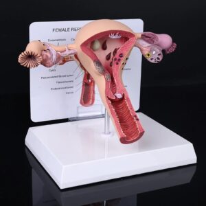 Uterus and Ovary Model, Human Anatomical Model Pathological Female Reproductive Organ Model for School Teaching Demonstration, Educational Tool