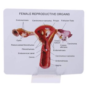 Uterus and Ovary Model, Human Anatomical Model Pathological Female Reproductive Organ Model for School Teaching Demonstration, Educational Tool