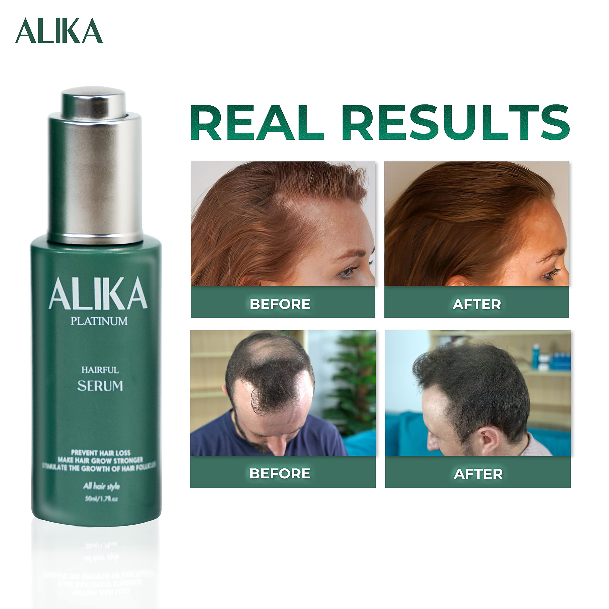 ALIKA Hair Growth Serum - Scalp Treatment for Hair Loss, Grow Gorgeous Hair for Women and Men, Suitable for Dry, Oily, Normal Scalp (50ml)