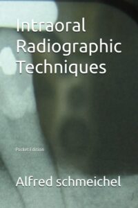 intraoral radiographic techniques: pocket edition