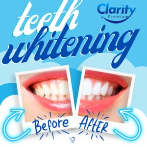 Whiting Stripes | White Teeth Strips | 28 Whitening Strips for Teeth | 14 Teeth Whitening Strip Treatments White Strips | Blanqueador de Dientes | Whitestrips | Safe & Effective Fast Results