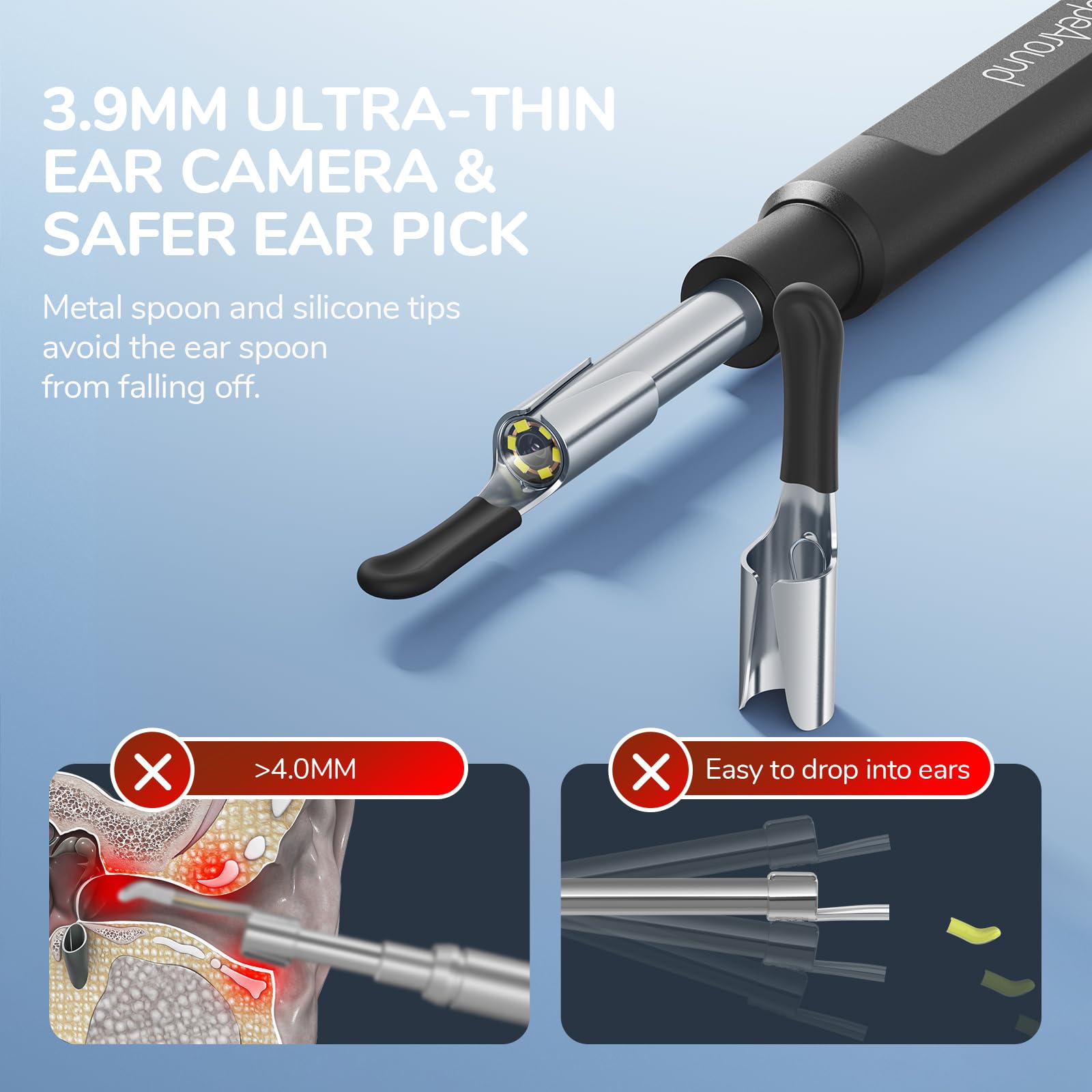 ScopeAround Otoscope Ear Camera, Ear Wax Removal Tool 1080P Otoscope