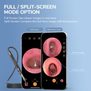 ScopeAround Otoscope Ear Camera, Ear Wax Removal Tool 1080P Otoscope