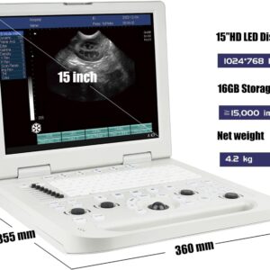 JZRYL Portable Vet/Veterinary B-Ultrasound Scanner with 3.5Mhz Convex Probe for Horse,Goat,Cow,Sheep and Pig use (3.5 MHz Convex Probe)