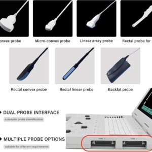 JZRYL Portable Vet/Veterinary B-Ultrasound Scanner with 3.5Mhz Convex Probe for Horse,Goat,Cow,Sheep and Pig use (3.5 MHz Convex Probe)