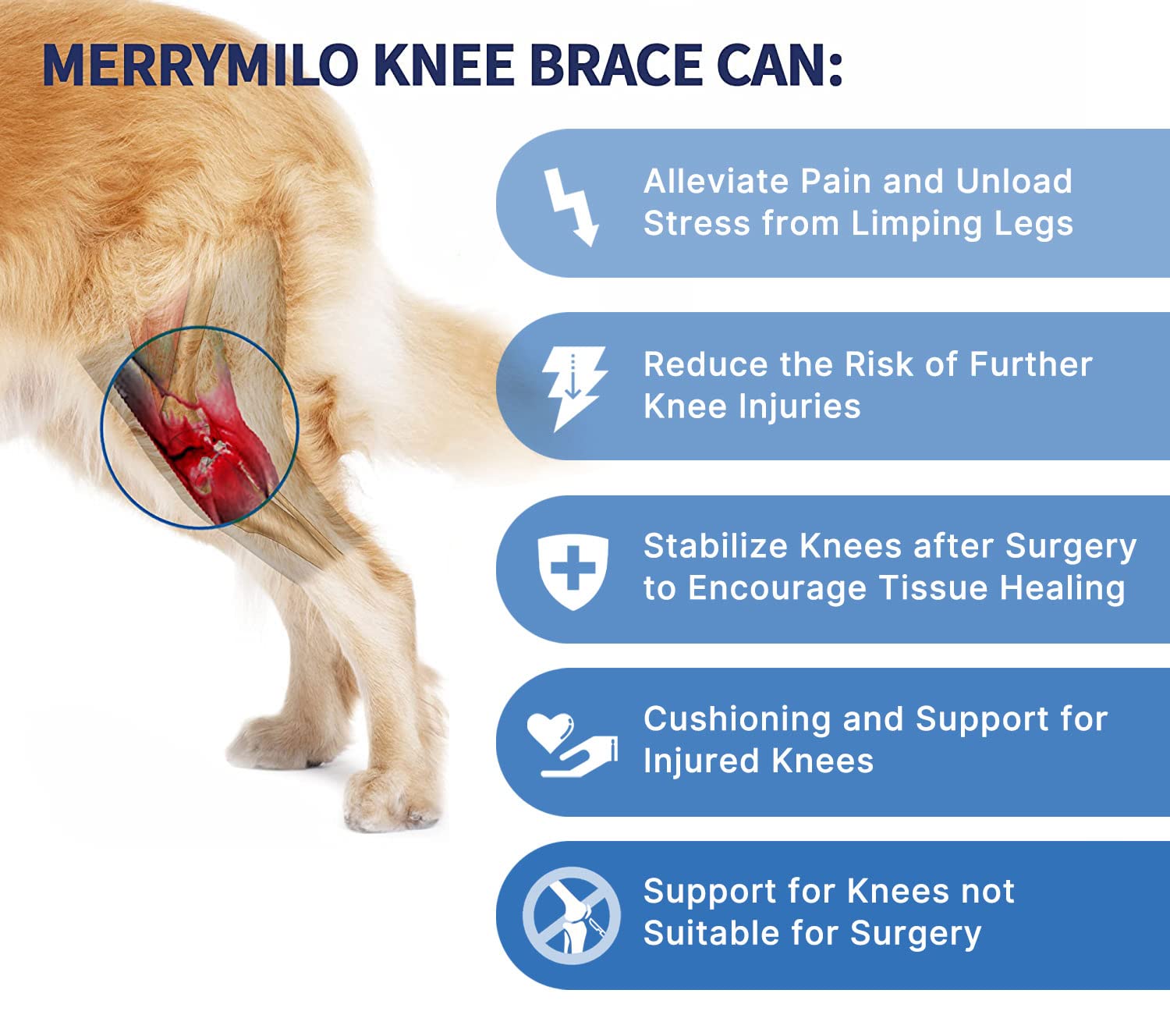 MerryMilo Dog Knee Brace for Hind and Rear Leg, Dog Hip Brace Support for Dog Ligament Injury Joint Pain, Size XL