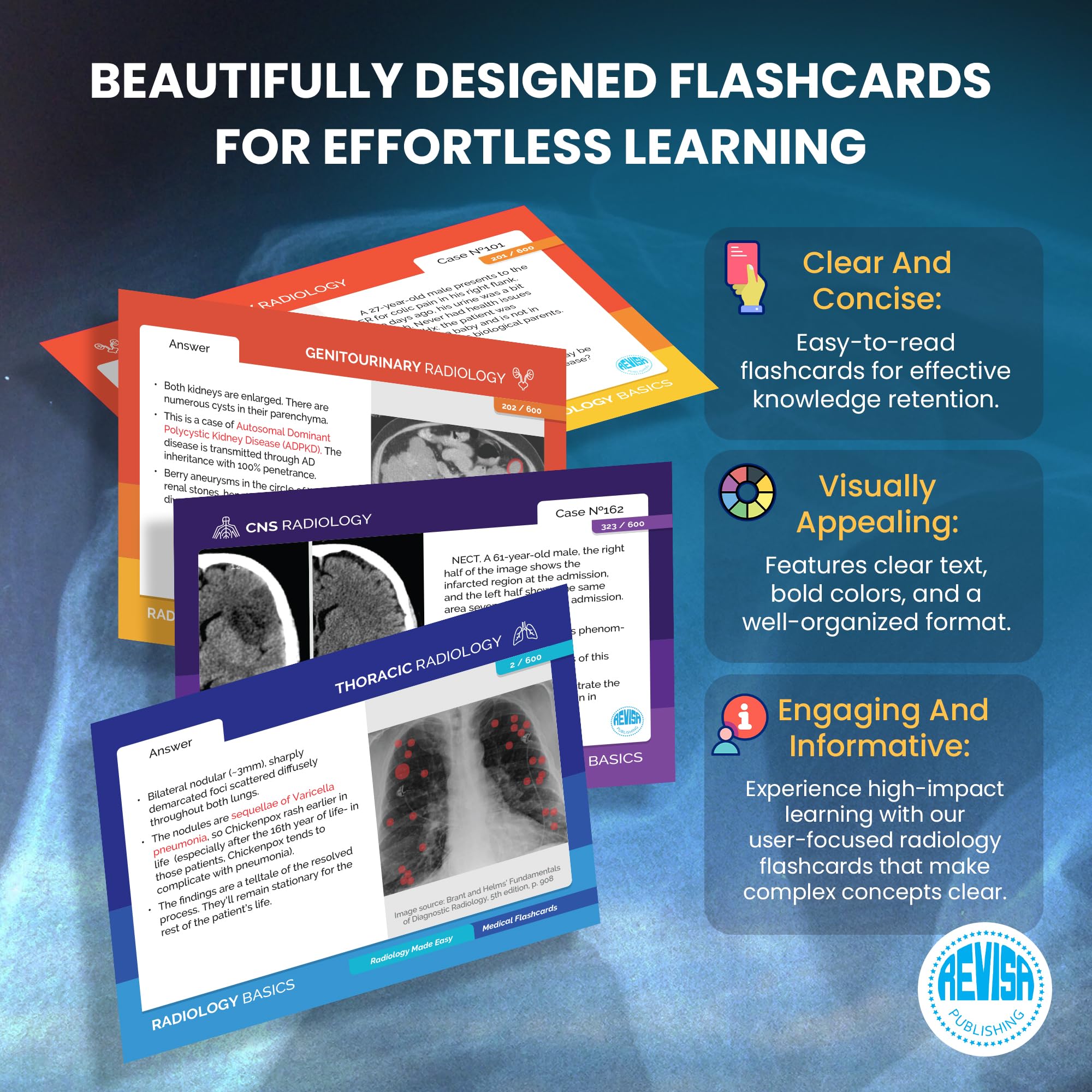 Revisa Radiology Prep Flashcards – 300pcs Radiology Test Prep Flashcards with ACR References - Essentials of Radiology Basics. Diagnostic Case Review Series - Radiology Tech Student Essentials