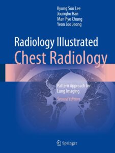 radiology illustrated: chest radiology: pattern approach for lung imaging