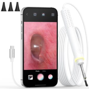 scopearound otoscope, 3.9mm ultra-thin ear camera with 6 led lights, digital otoscope with ear wax removal tool, usb plug & play ear wax camera compatible with iphone 15/android