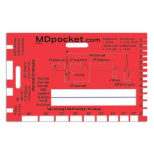 rapid id - ekg intervals and infarctions with clear window