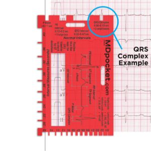 Rapid ID - EKG Intervals and Infarctions with Clear Window