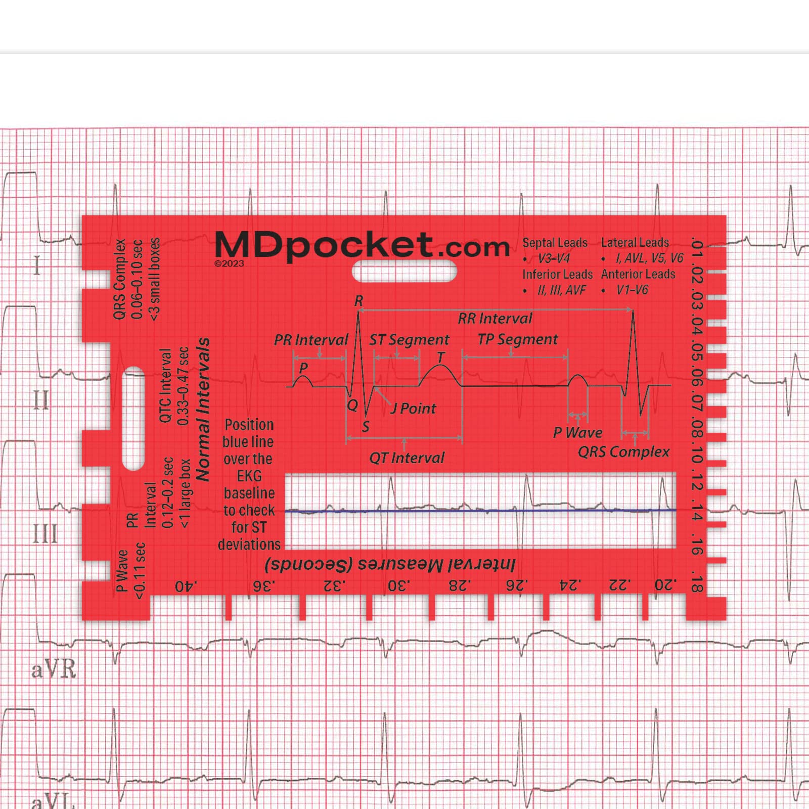 Rapid ID - EKG Intervals and Infarctions with Clear Window