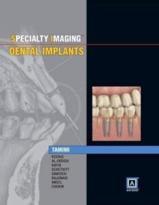 specialty imaging: dental implants