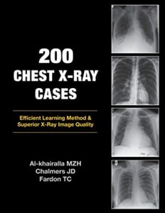 200 chest x-ray cases