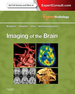 imaging of the brain: expert radiology series