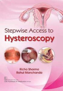 stepwise access to hysteroscopy