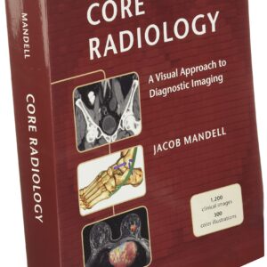 Core Radiology: A Visual Approach to Diagnostic Imaging