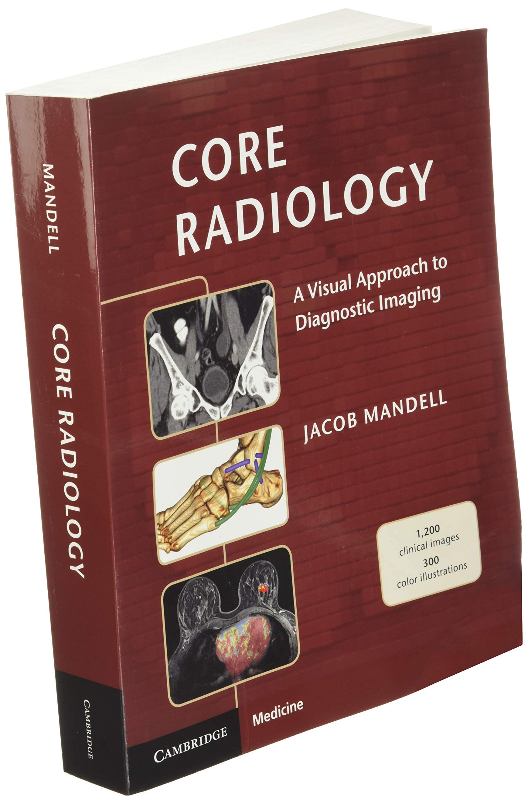 Core Radiology: A Visual Approach to Diagnostic Imaging