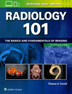 radiology 101: the basics and fundamentals of imaging