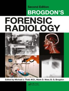 brogdon's forensic radiology